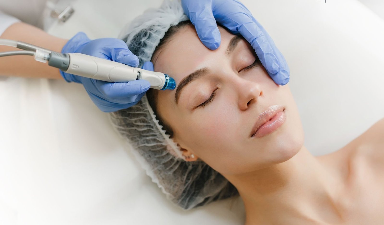 Acne Scar Resurfacing – Harley Medclinic